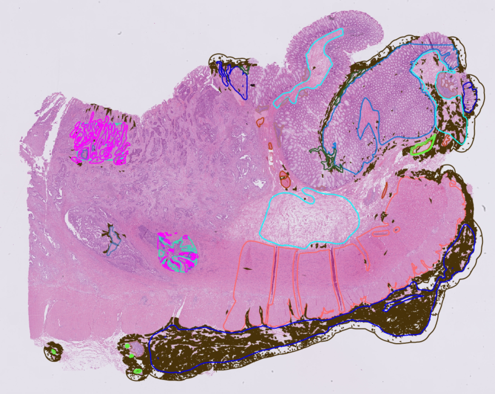 Data | SemiCOL Challenge