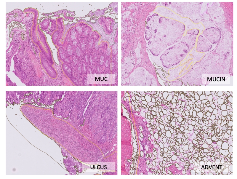 Data | SemiCOL Challenge